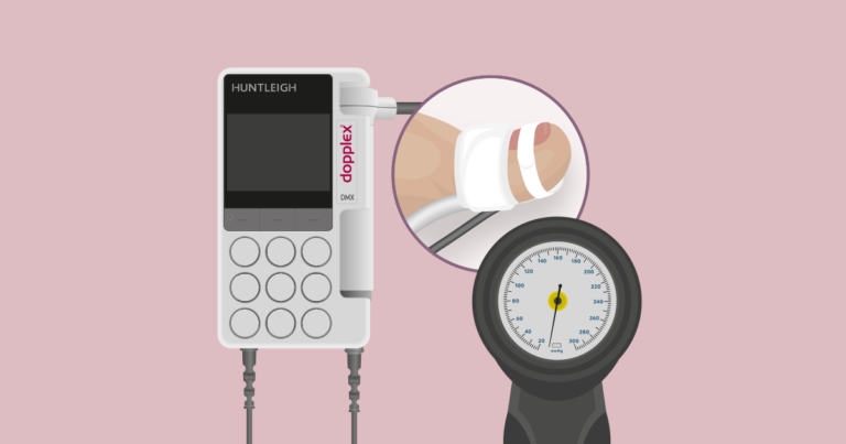 TBPI (Toe Brachial Pressure Index) - Huntleigh Healthcare